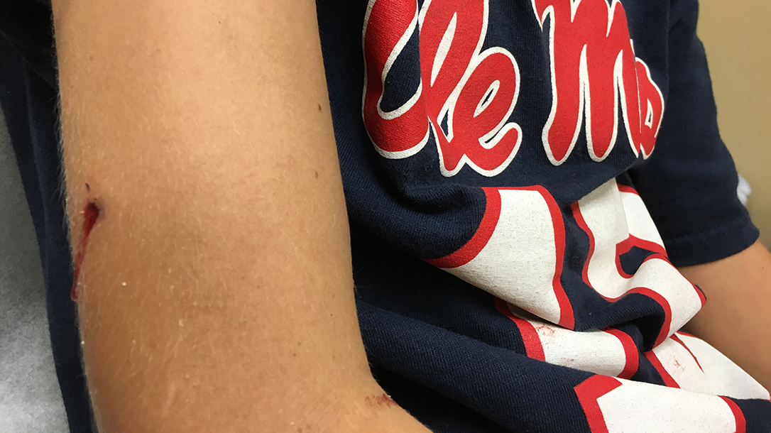 Gunshot Wounds: 8 Real-Life Cases on the Receiving End of Gunfire ...