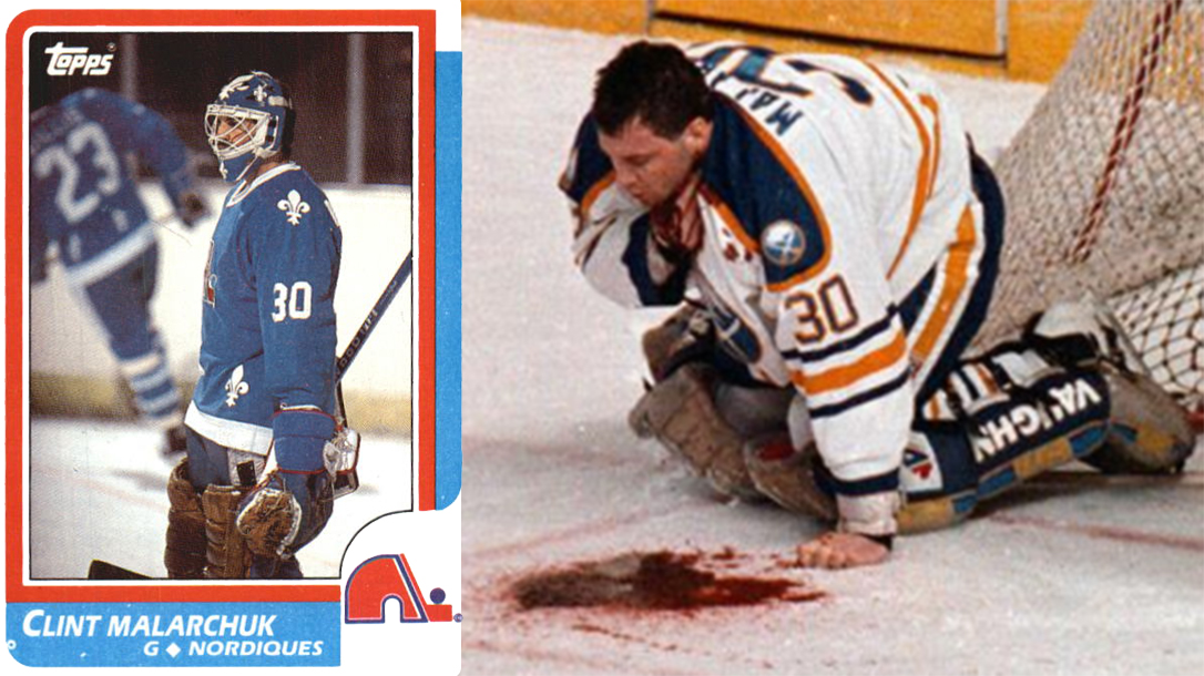 Hockey’s Ultimate Badass, Clint Malarchuk : The Short Return To Ice Time